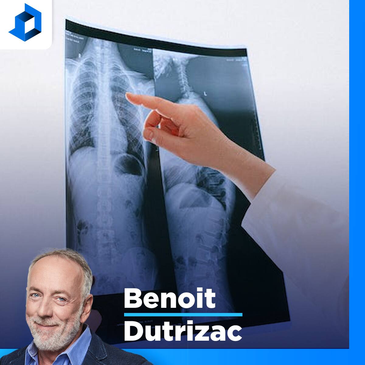 Cancer du poumon : un nouveau médicament très prometteur | Benoit ...